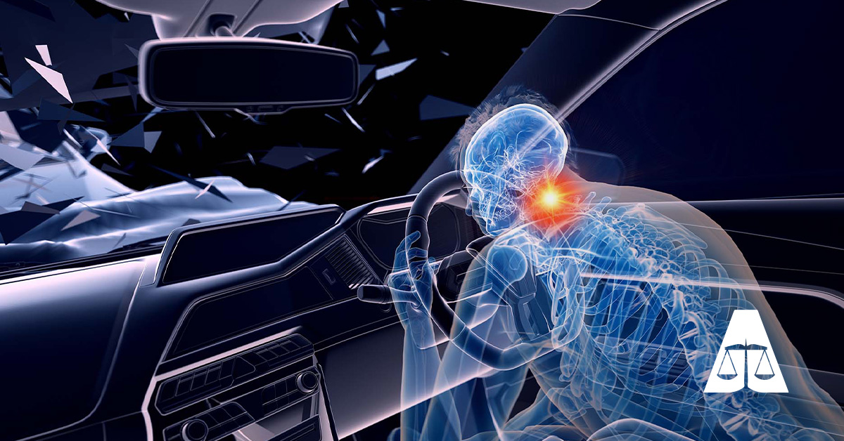 Whiplash Injury Lawyer Alberta - Assiff Law Office