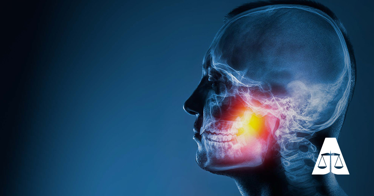 TMJ Injury Lawyer Alberta - Assiff Law Office